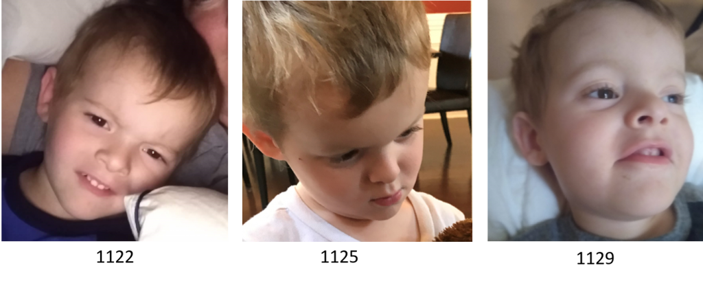 Head Shape Comparisons During Children’s Brain Growth - The Observant Mom