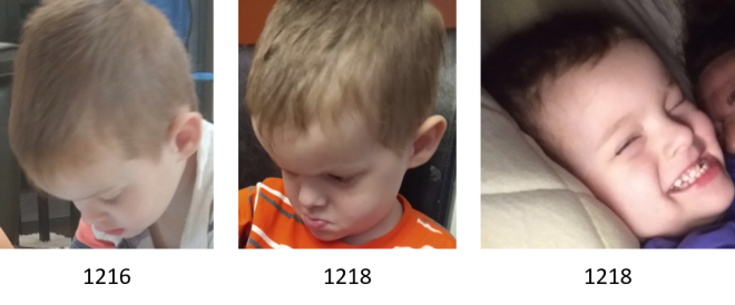 Head Shape Comparisons During Children’s Brain Growth - The Observant Mom